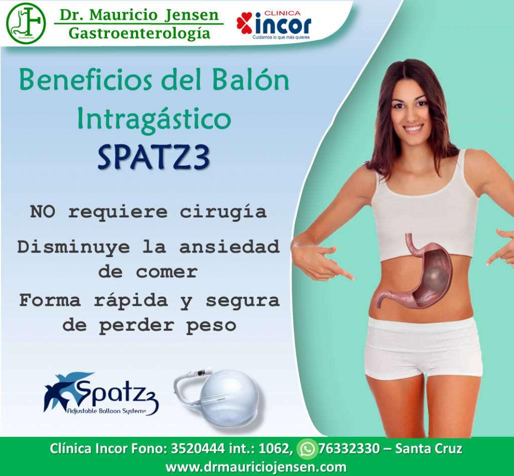 Beneficios del Balón Intragástrico - Dr. Mauricio Jensen Medico ...